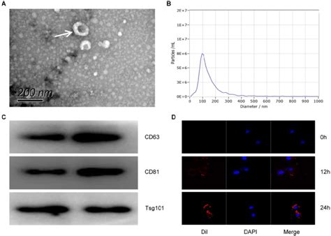 The Characterization And Identification Of Circulating Exosomes A