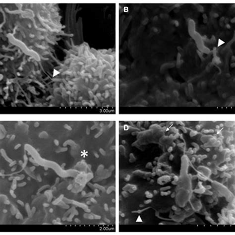 Host Attachment And Invasion By Campylobacter Concisus Unswcd Adapted