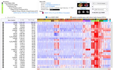 Human Brain Atlas Api Allen Human Brain Atlas Allen Brain Map