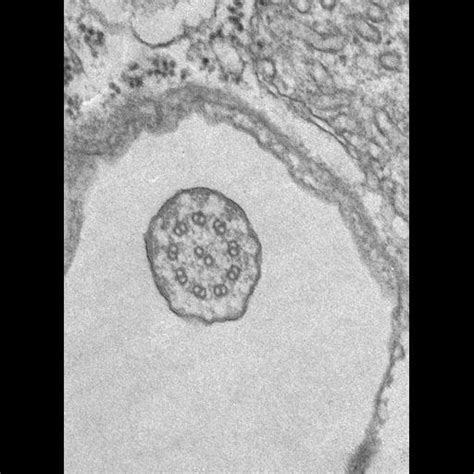 Cil 34604 Tetrahymena Pyriformis Cell By Organism Eukaryotic Cell