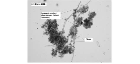 Primary Sludge Microscope Image 40Â Dialux 20 Eb Download