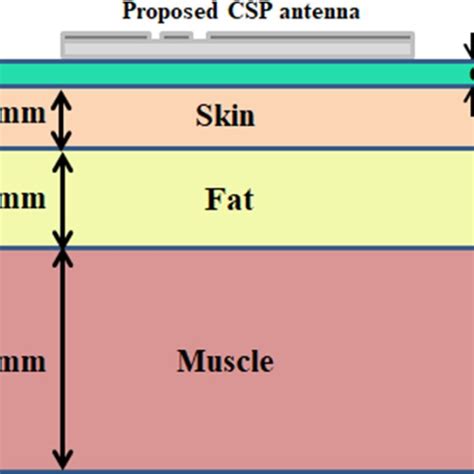 Human Body Simulation Model Of Comb‐shaped Patch Antenna Download