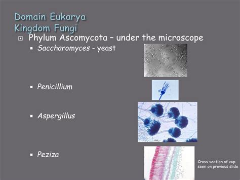 Phylum Ascomycota Microscope Phylum Ascomycota Microscope