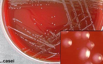 Lactobacillus Casei Plated