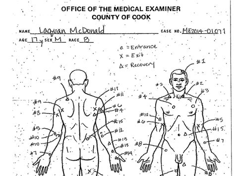 Blank Autopsy Body Diagram