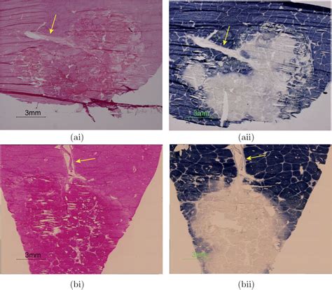 Exemplary Hande I And Nadh D Ii Stainings Of Lesions Induced In The Download Scientific
