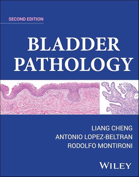 Bladder Pathology 9781119707554 Medicine And Health Science Books