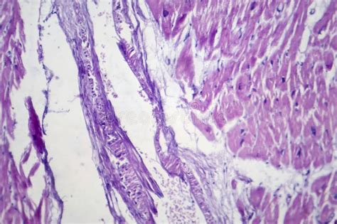 Cardiac Hypertrophy Light Micrograph Stock Image Image Of Fibers