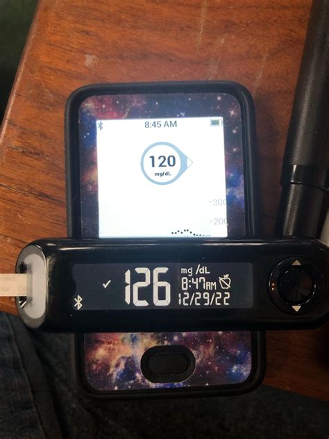 Reusing Dexcom Sensor Rdiabetes