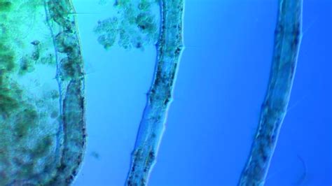 1 152 Microscopic Worm Stock Videos Footage And 4k Video Clips Getty Images