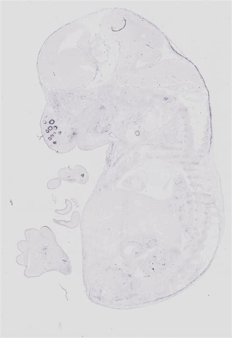 Lrrc15 Rna In Situ Gene Expression Assay Gxd