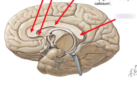 Corpus Callosum Diagram Quizlet