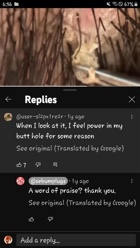 No 52 Tightly Packed Sebum Plug R Popping