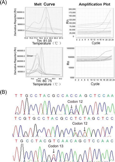 The Feasibility Was Tested For 7 Hotspot Mutations Detecting Of Kras Download Scientific