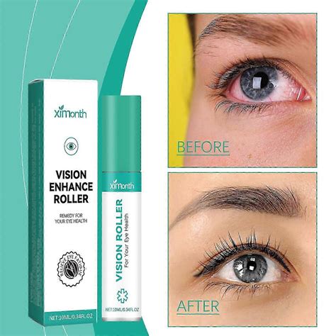 Vision Enhance Roller Ophthalmic Vision Enhance Roller Vision Enhance