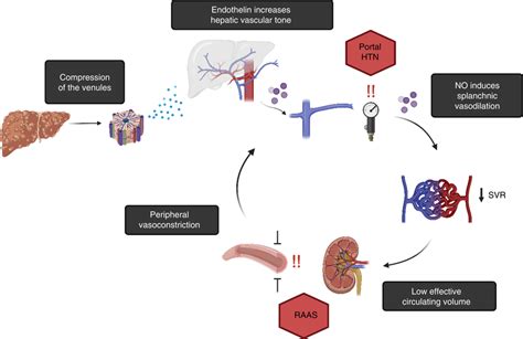 Pathophysiology Of Circulatory Dysfunction In Cirrhosis Scarring And