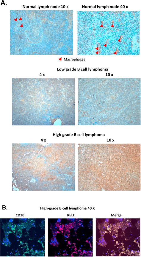Relt Is Expressed In Human Lymph Nodes And B Cell Lymphomas