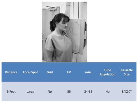 Radiography Positioning Spine Ppt Radiography Positioning Spine Ppt