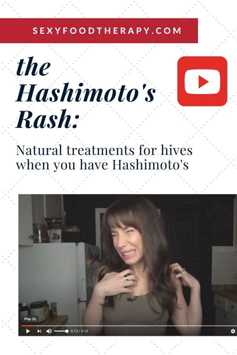 The Hashimoto S Rash Why Skin Issues Are Common And What To Do About It