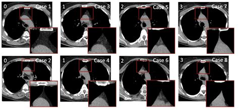 Unlocking The Secrets Of The Thymus A Window Into Immune System Aging