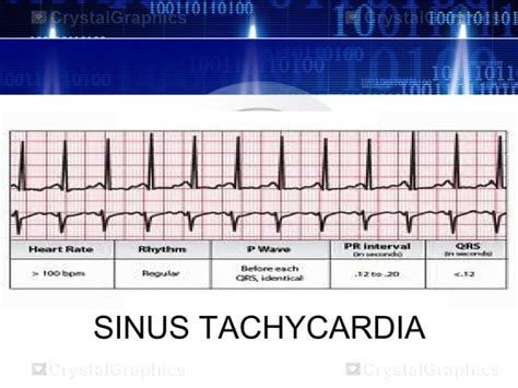 Electrocardiography Ppt