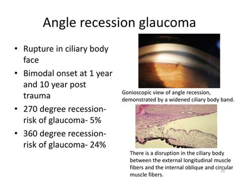 Secondary Glaucoma Finalpptx Eye And Vision Conditions Diseases And Conditions