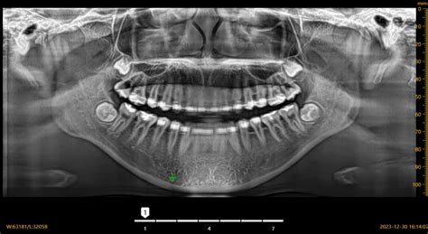 D50 Cbct
