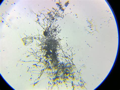 Penicillium Under Microscope 100x