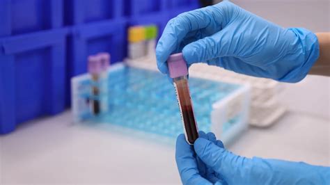 guide to coding for prediabetes and diabetes mellitus icd 10 and cpt codes