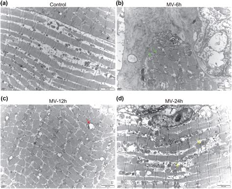 Morphologic Abnormalities Of Mitochondria And Autophagy In The Hot Sex Picture