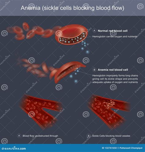 Hemoglobins Improperly Forms Long Chains Giving Cell Its Sickle Vector
