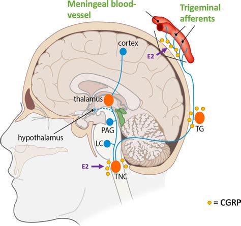 Sex Specific Metabolic Profiling To Explain The Increased Cvd Risk In Women With Migraine A