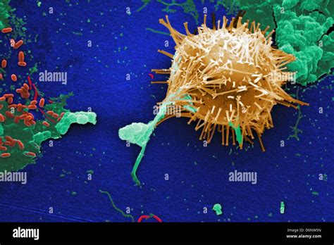 This Digitally Colorized Scanning Electron Micrograph SEM Untreated Water Specimen Extracted
