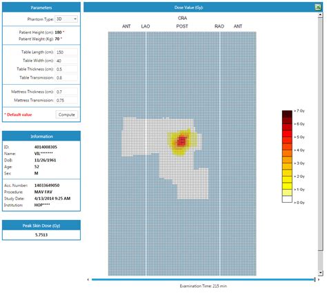 Radiation Dose Monitor Dose Management Software Mptronic