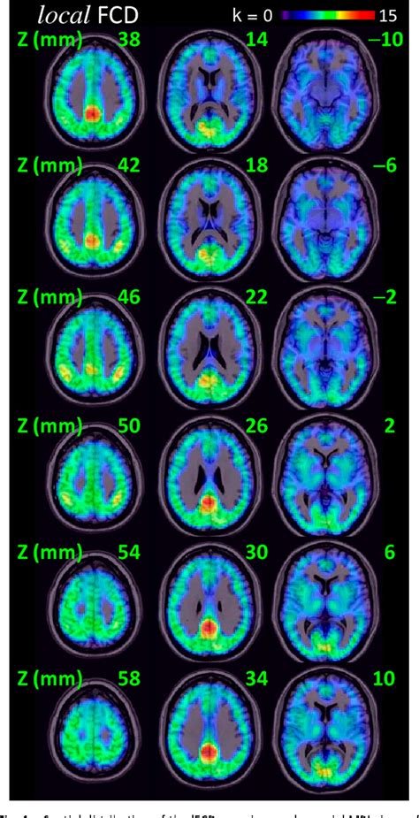 Figure 1 From Functional Connectivity Density Mapping Semantic Scholar