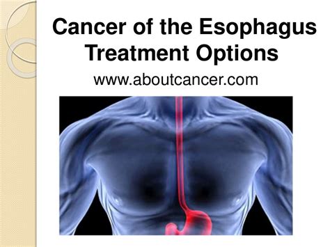 Esophagus Cancer
