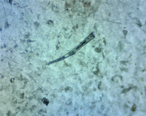 Lyme Pathogen At 1000x And 2500x Rlymephotos