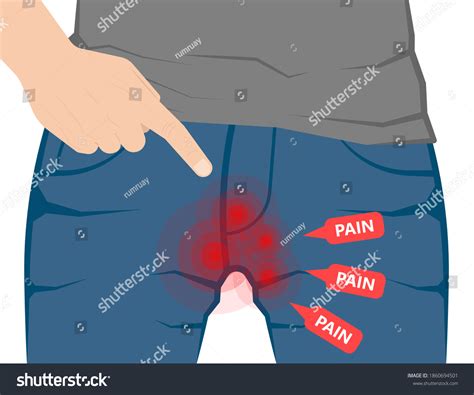 Testicular Disorder Men Vas Pus Tube Stock Vector Royalty Free 1860694501