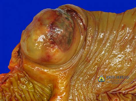 Hamn Surgical Pathology Photo Website