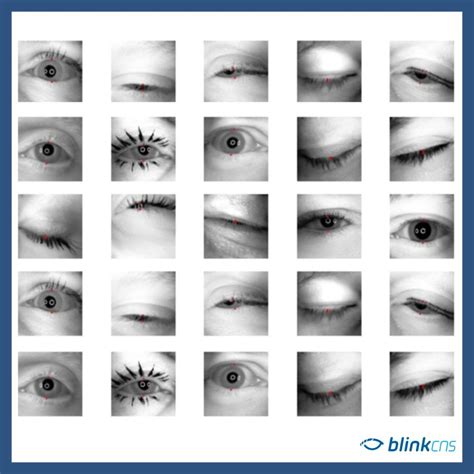 Objective Data In The Blink Of An Eye 👁‍🗨 We Are Thrilled That Our