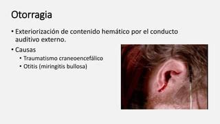 Semiología Del Aparato Auditivo Pptx