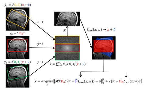 Figure 1 Illustration Ofthe Cnn Based Motion Correction Algorithm