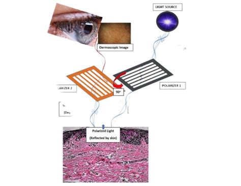 Dermoscopy — Dermapamine By Dermapamine Club