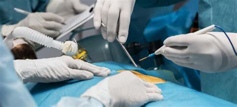 Decoding The Benefits Why Opt For Microscopicendoscopic Surgery