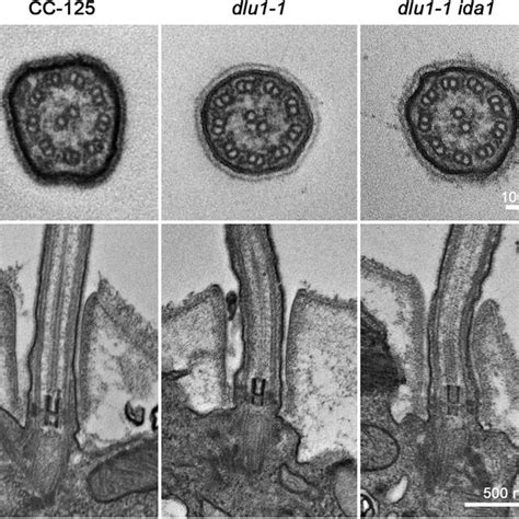 Ultrastructure Of Cilia Lacking Lc1 Electron Micrographs Of Ciliary