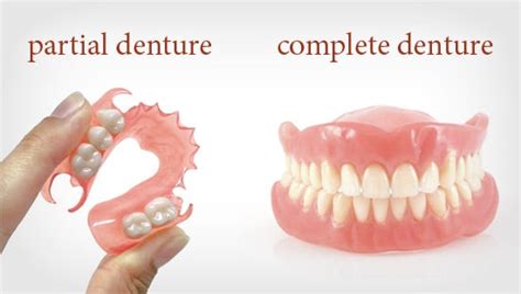 Tips For Getting A Full And Partial Denture At The Same Time