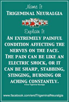 Trigeminal Neuralgia