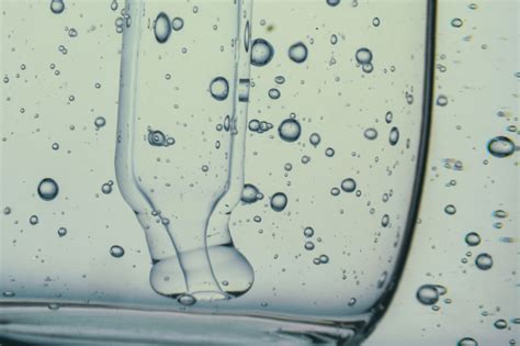 Why The Future Of Drg Payment Integrity Is Pre Pay—and What It Takes To