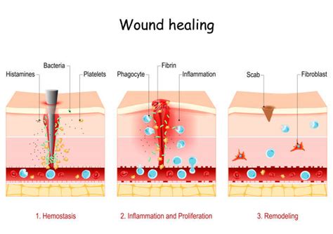 Types Of Skin Wounds