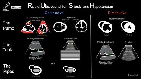 Pocus Ultrasound Pocket Cards Pocus 101